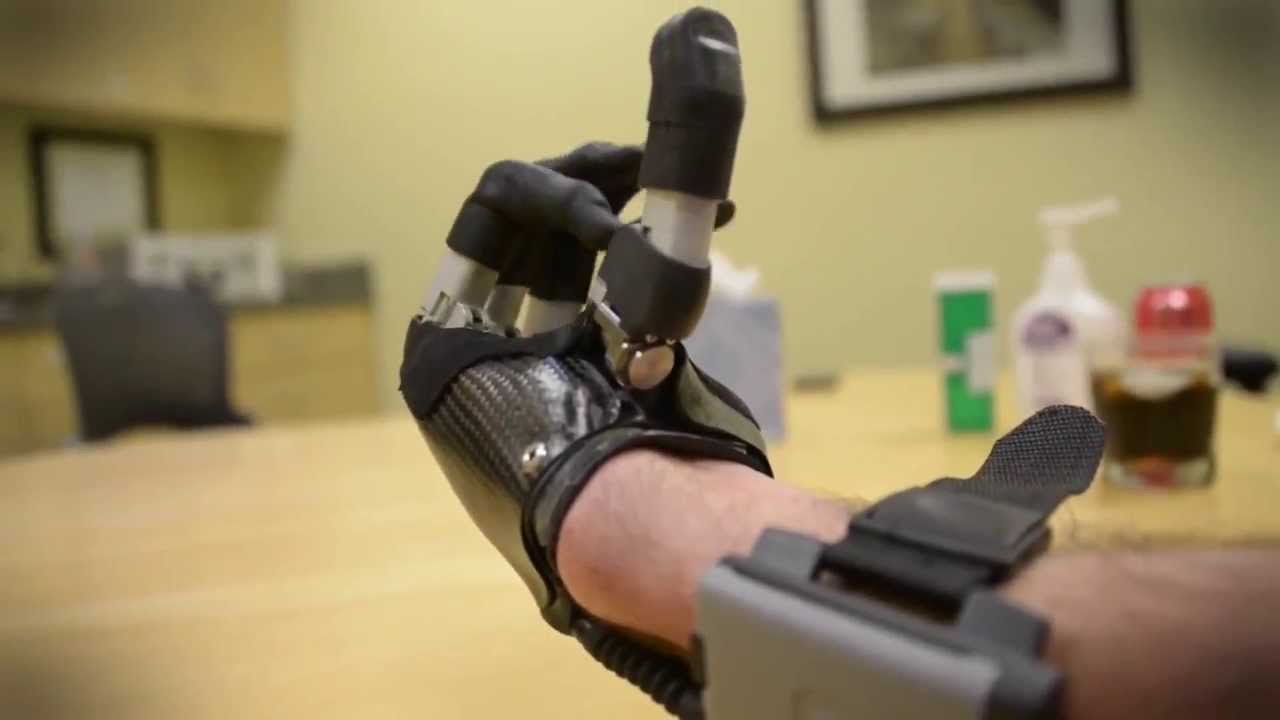 Next-gen artificial limbs help amputees grab onto a better life - YouTube
