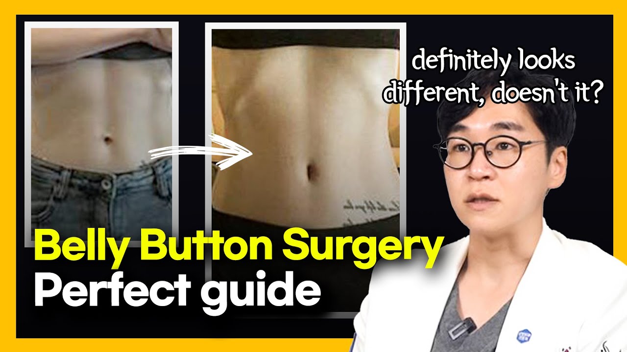 Belly Button Surgery Navel Surgery Umbilicoplasty Link Plastic Belly Button Surgery Navel Surgery Umbilicoplasty Link Plastic
