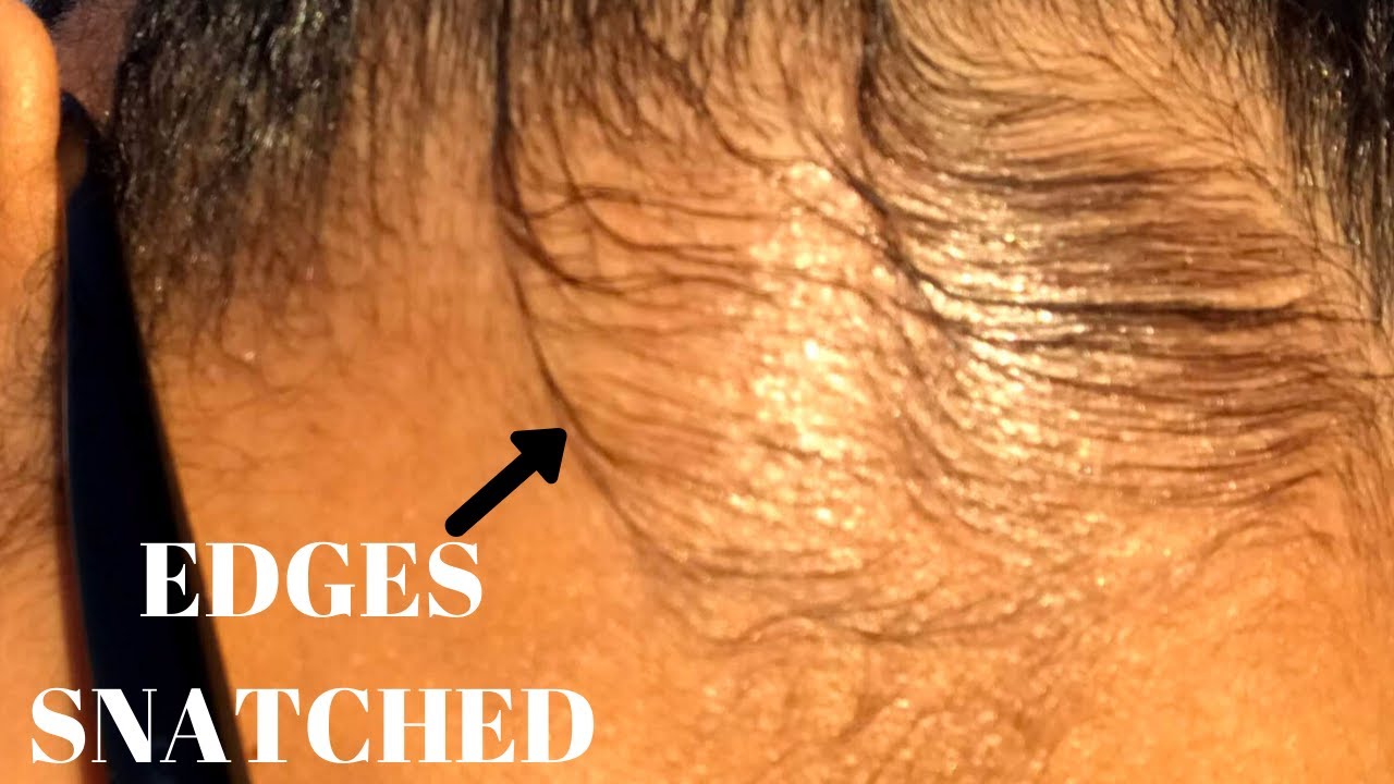 TRUE LIFE: MY EDGES SNATCHED (SCARED WOMAN) - YouTube