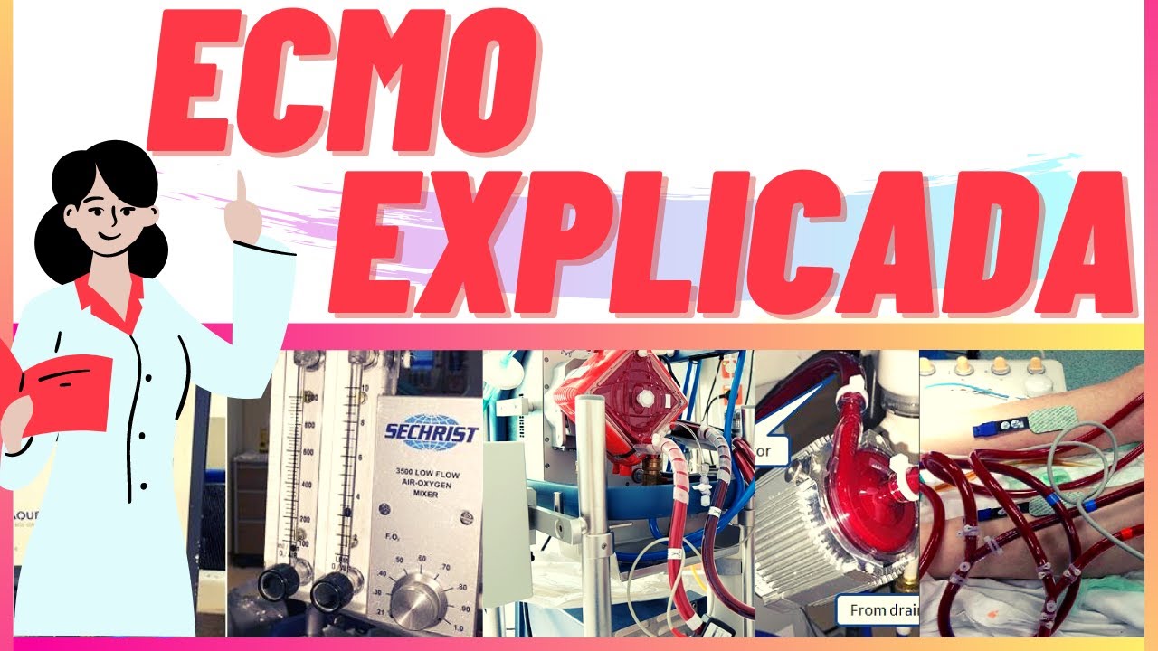 Diagrama De Circuito Ecmo ECMO: Oxigenación Extracorpórea De Las