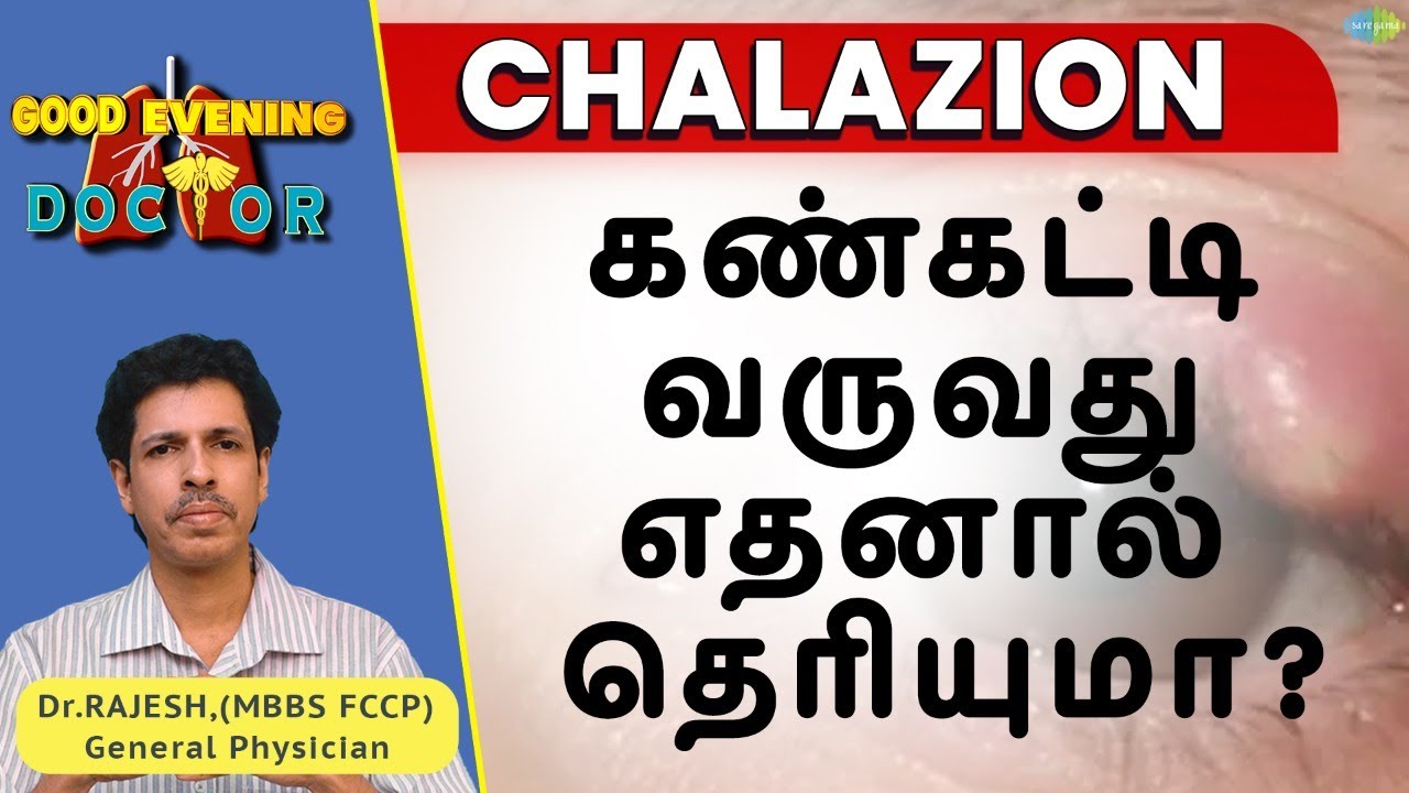 கண்கட்டி வருவது எதனால் தெரியுமா? | EP 64 | Good Evening Doctor | Dr ...
