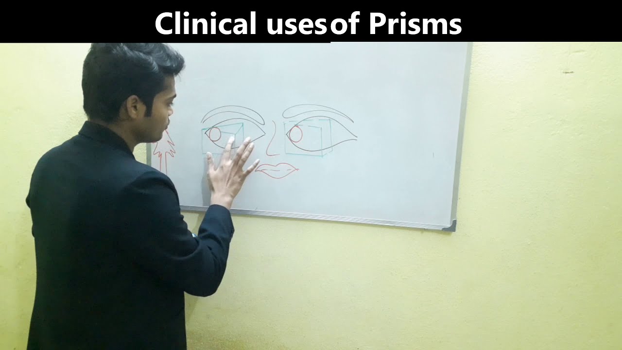 Clinical "uses of Prisms" part 2/2 - YouTube