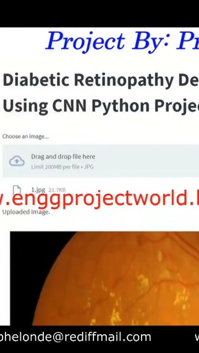 Diabetic Retinopathy Detection Using CNN Python Project Code #shorts - YouTube