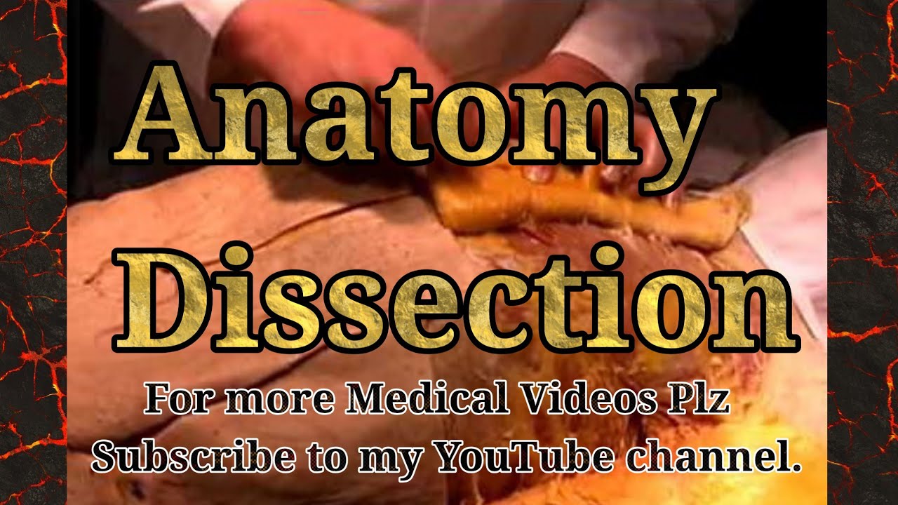 Anatomy Dissection | Medical Students | Medicine | Dissection ...