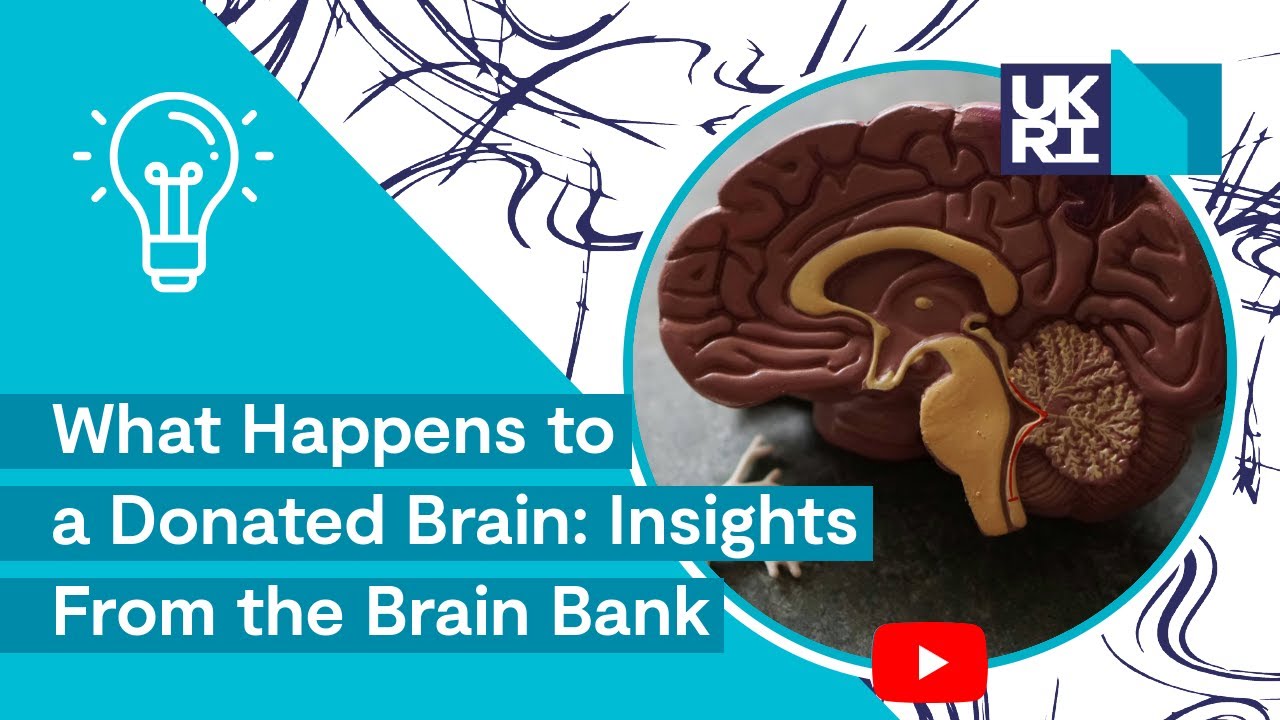 What Happens to a Donated Brain | Insights From the South West Dementia ...