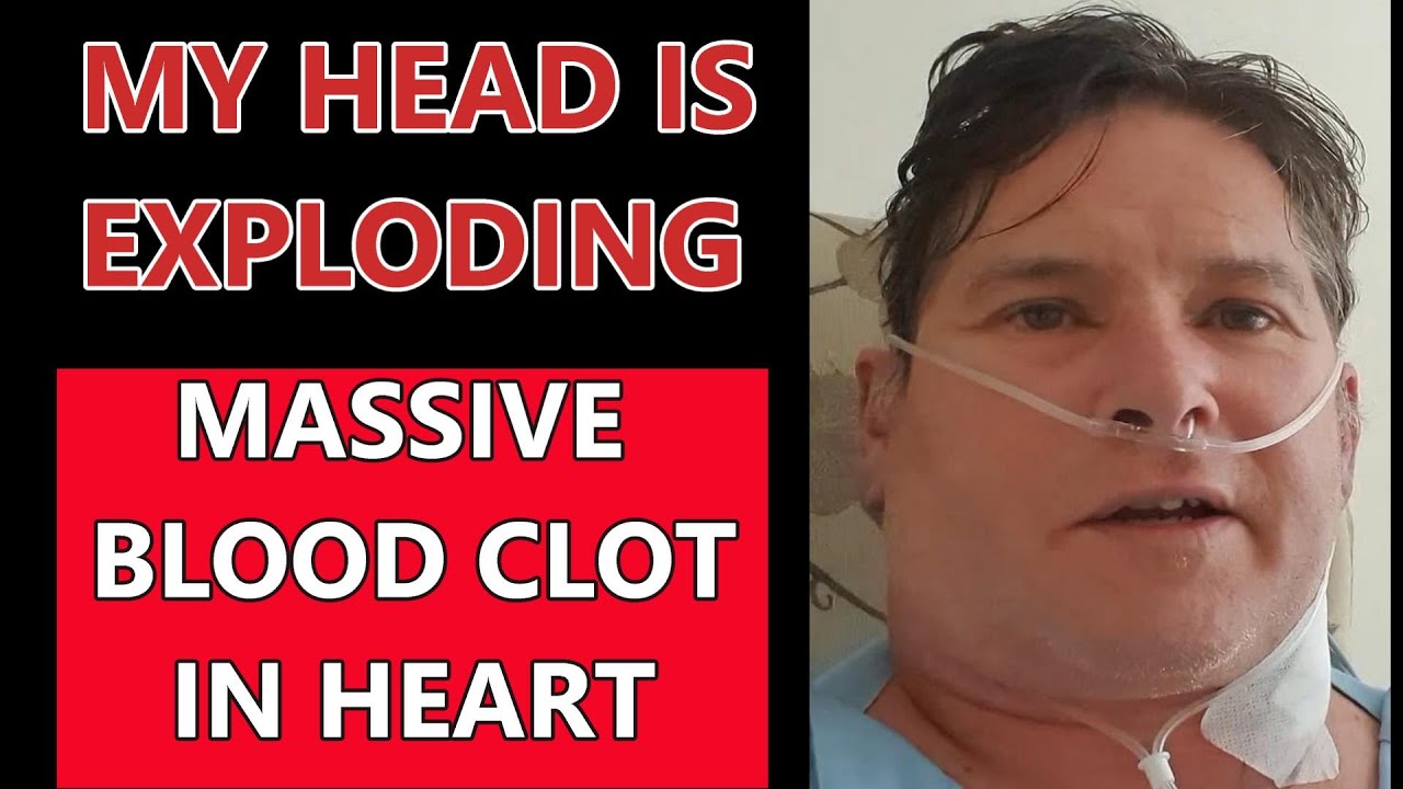 Heart Blood Clot - My head is exploding - YouTube