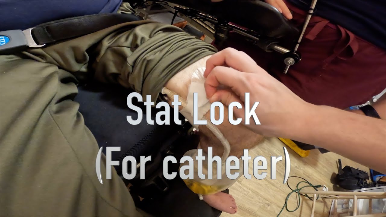 Securing Stability: Essential Role of StatLock Stickers for Urinary ...