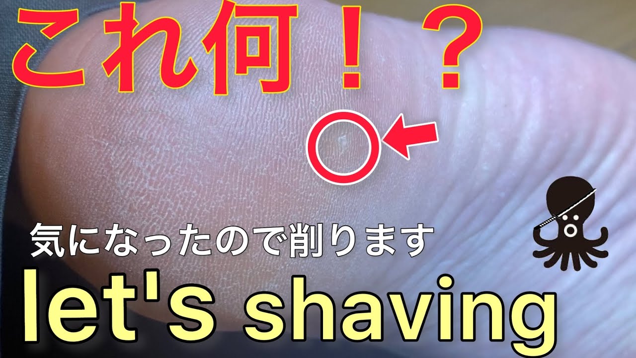 Corn Self Care Shaving I Have A Corn On My Right corn-self-care-shaving-i-have-a-corn-on-my-right