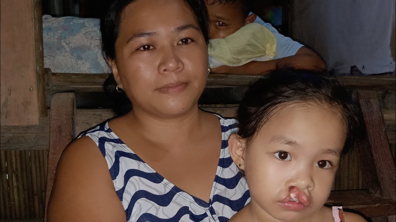 Ang Kawawang Bata Na May Butas Sa Puso... - YouTube