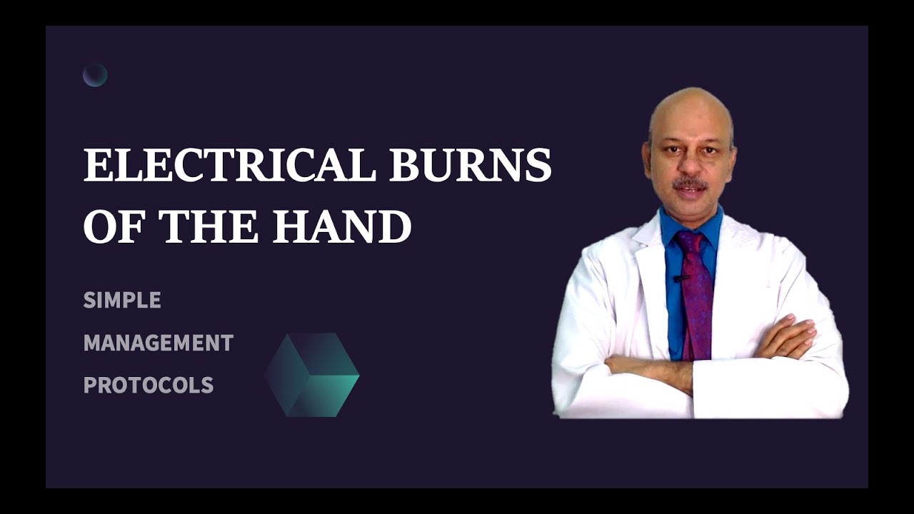 Electrical Burns of the Hand: Simple Management Protocol - YouTube