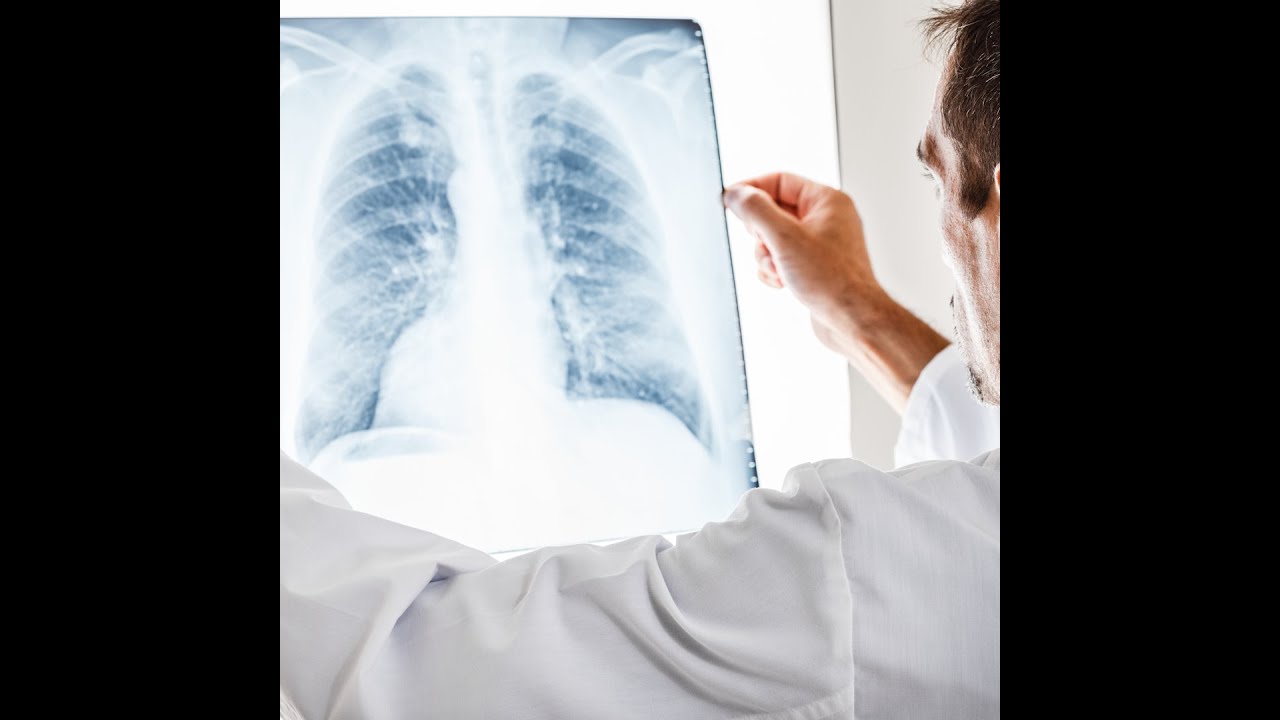 Silicoza, boala oamenilor care lucrează în medii toxice - YouTube