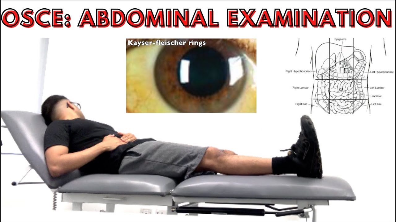 OSCE Abdominal Examination - YouTube