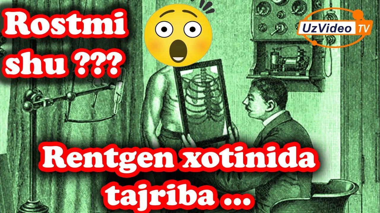 Ixtirolar olamida ajoyib 7 ta tasodif - Dunyo tasodiflari !!! - YouTube
