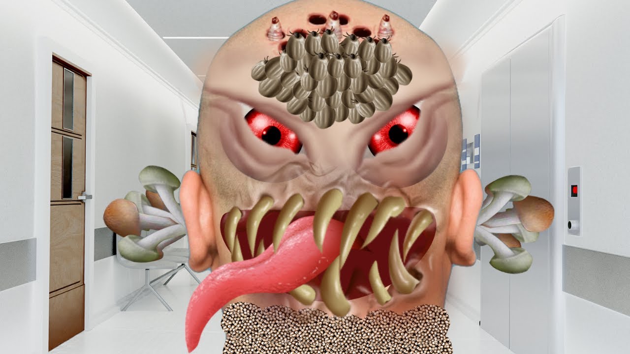 ASMR Treatment 2D Animation | Treatment Remove Parasite On Head ...