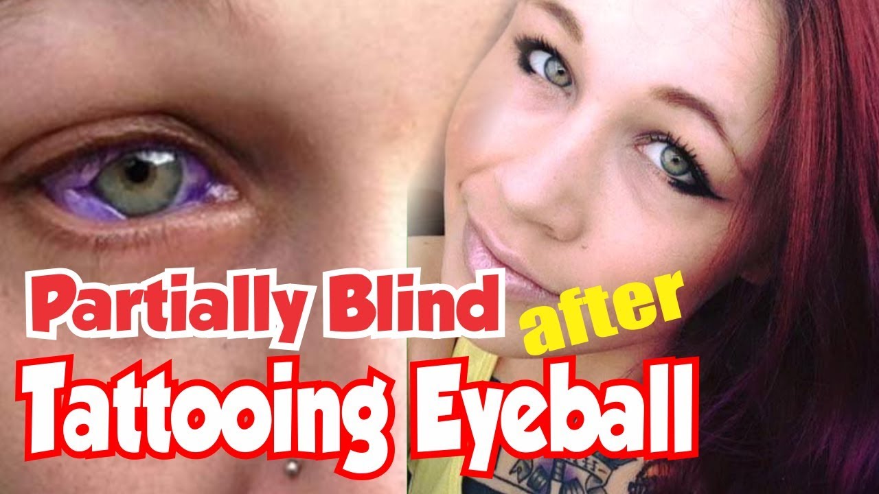 5 Things About Catt Gallinger, Partially Blind After Tattooing of the ...