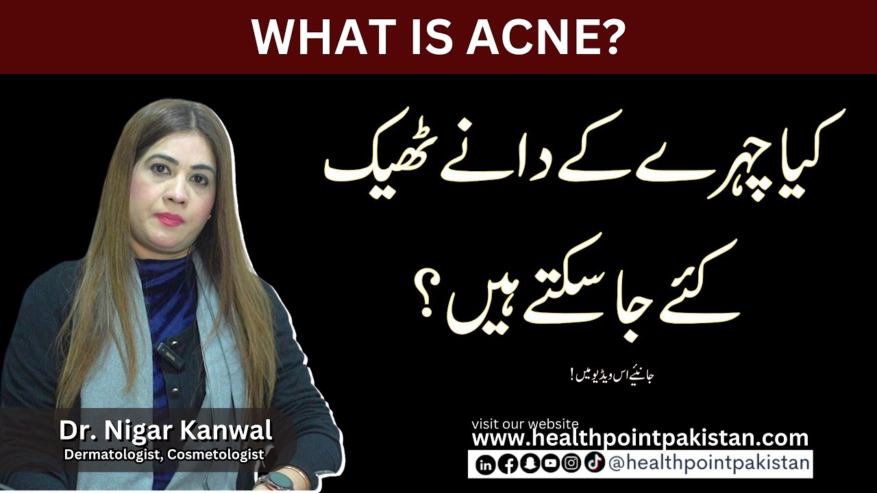 Is acne treatable? urdu/hindi | Dr. Nigar Kanwal Dermatologist - YouTube