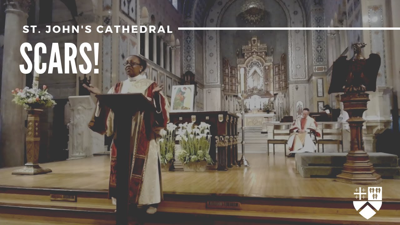 Scars! | Sermon - YouTube