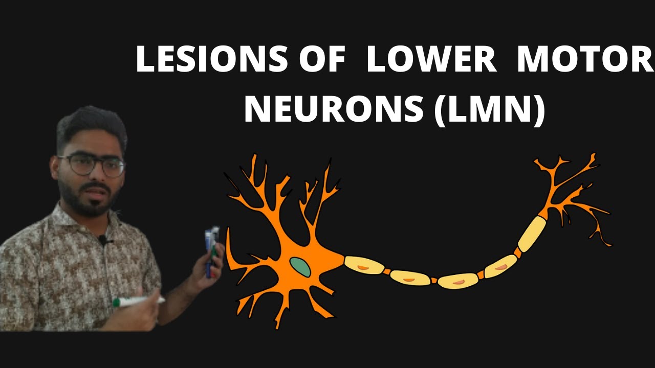 LOWER MOTOR NEURON LESIONS (LMN LESION) ( Urdu \ Hindi ) - YouTube