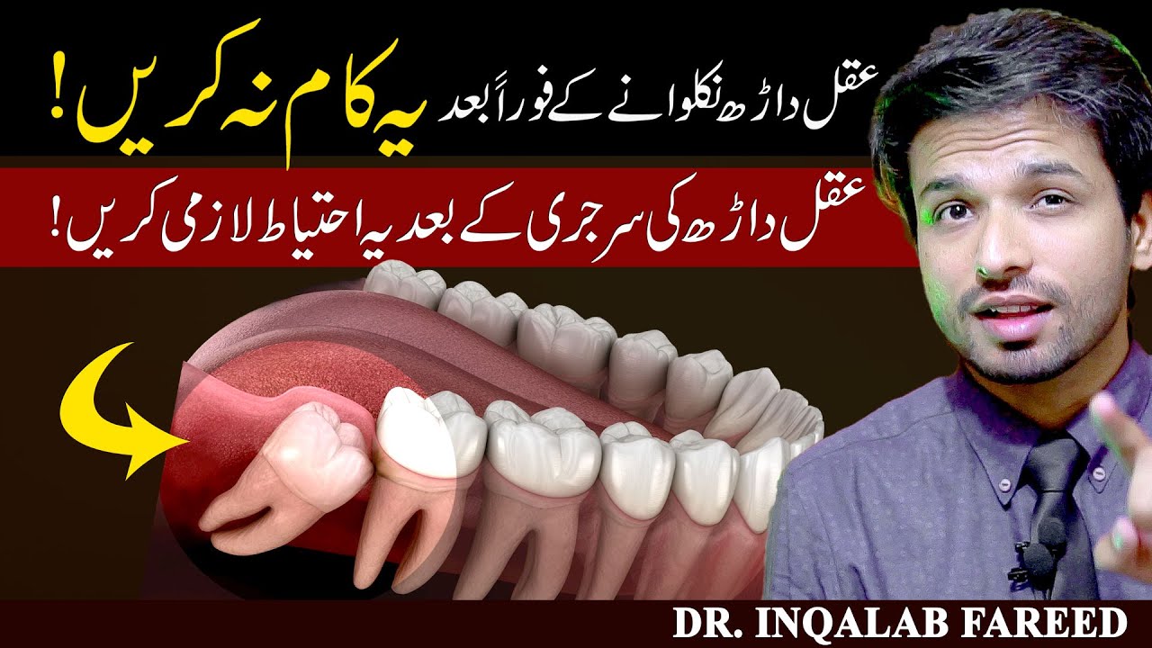 Never Do This After Third Molar Removal | Wisdom Tooth Surgery | - YouTube