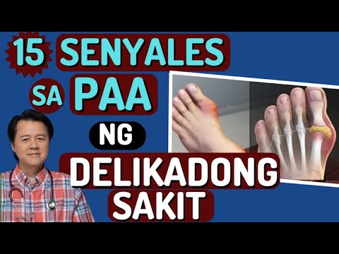 15 Senyales sa Paa ng Delikadong Sakit. - By Doc Willie Ong (Internist and Cardiologist) - YouTube