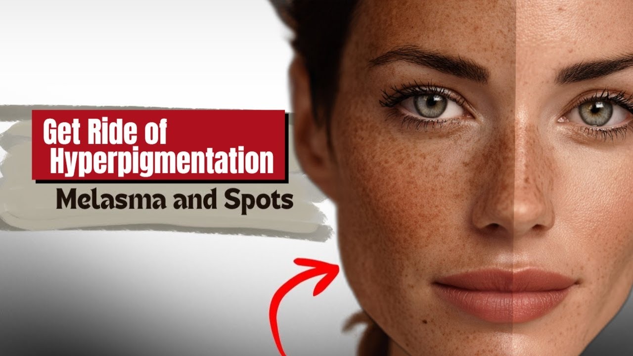 How to Actually Fade Hyperpigmentation (Tips + Products) - YouTube