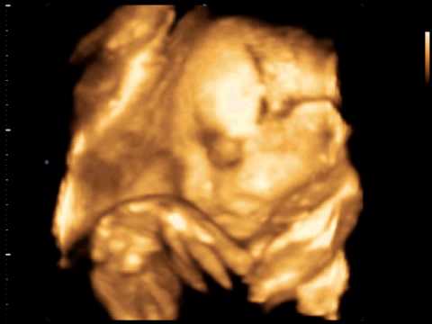 4D Scan at 30 weeks pregnant - YouTube