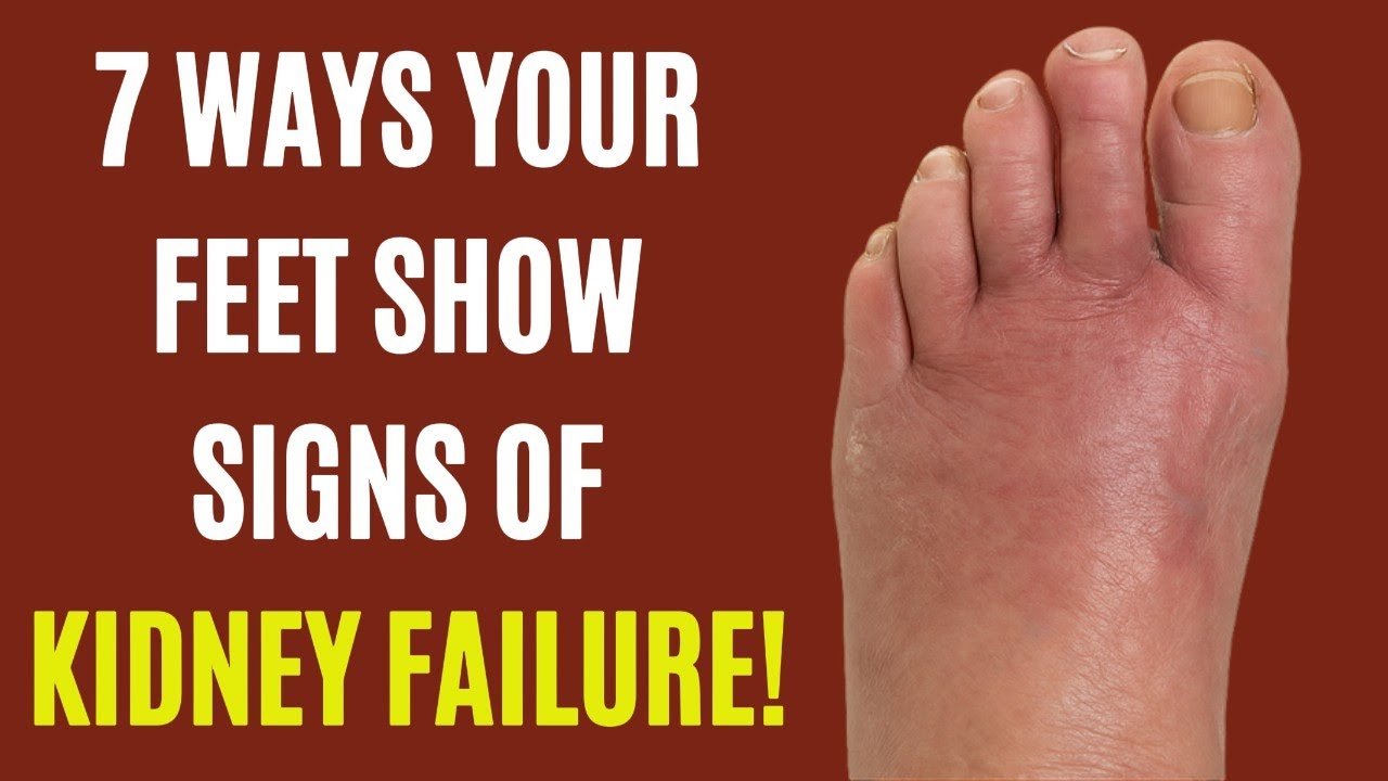 7 Hidden Signs of Kidney Failure in Your Feet – Seniors, Pay Attention ...
