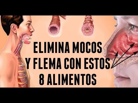 Elimina Mocos Y Flema Con Estos 8 Alimentos | Remedio Casero Para La ...