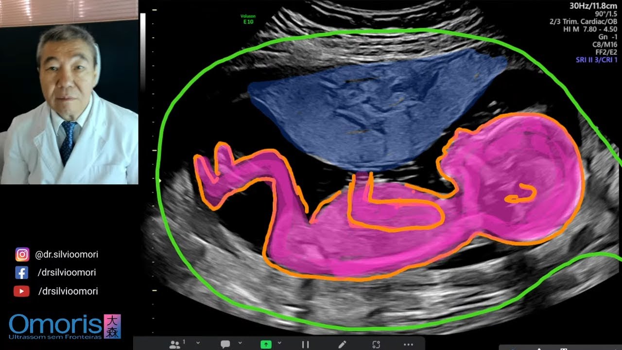 Gestação de 16 semanas - YouTube