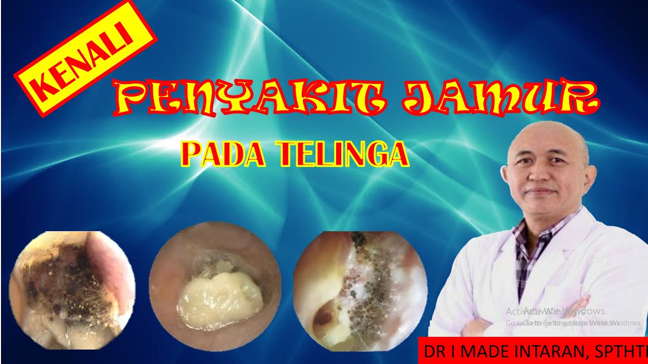 KENALI INFEKSI JAMUR PADA TELINGA - YouTube