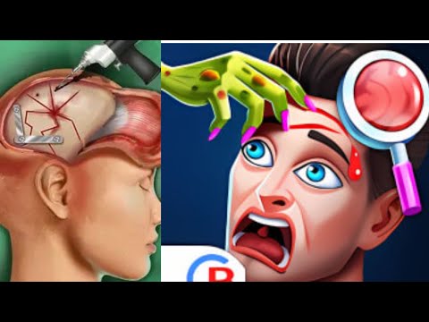 Treatment Surgery// Animation Tutorial YouTube videos - YouTube