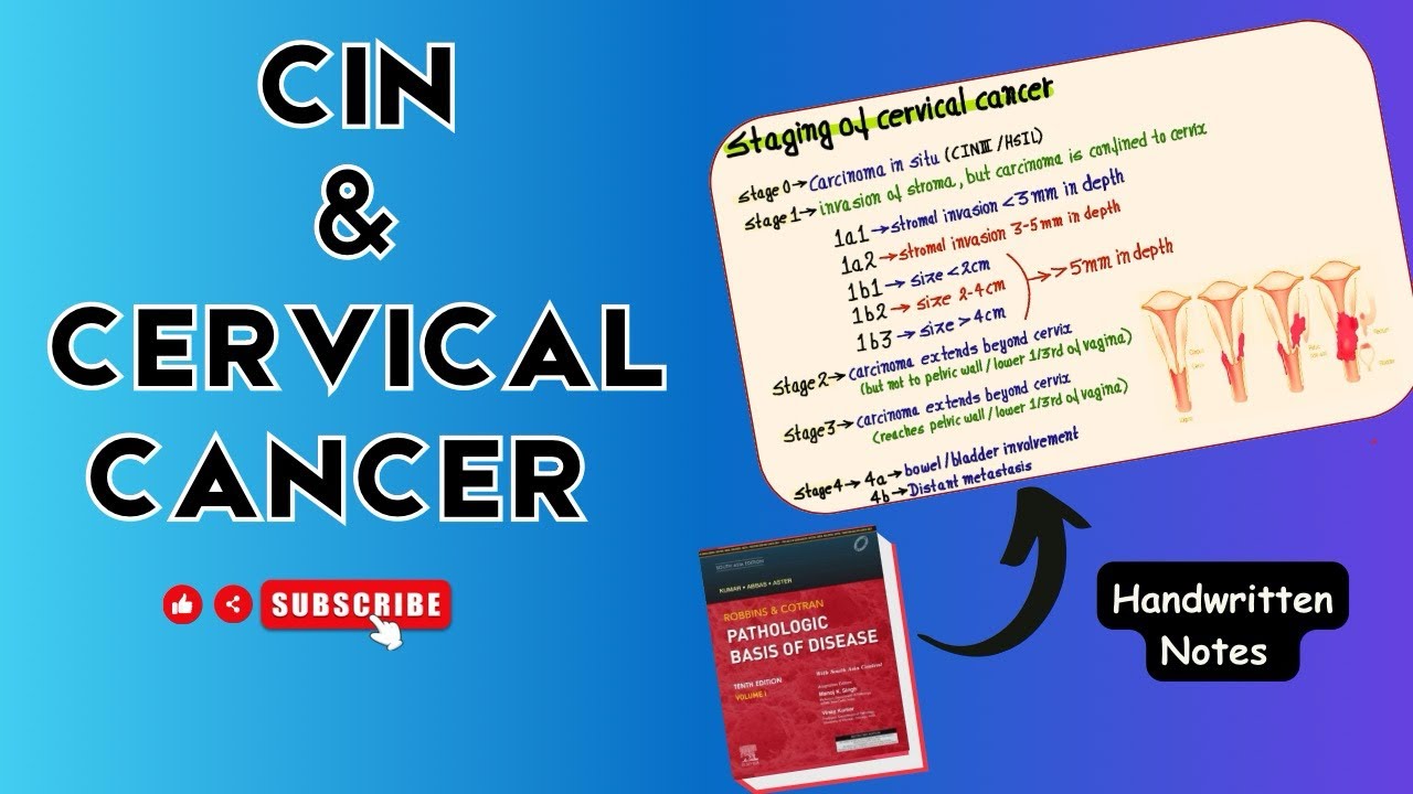 Pathology Of Cervical Cancer and Cervical Intraepithelial neoplasia ...