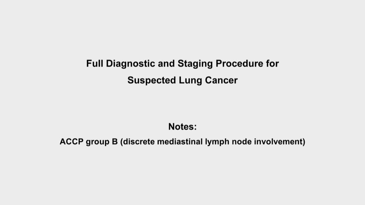 EBUS training video - full diagnostic and staging procedure for ...