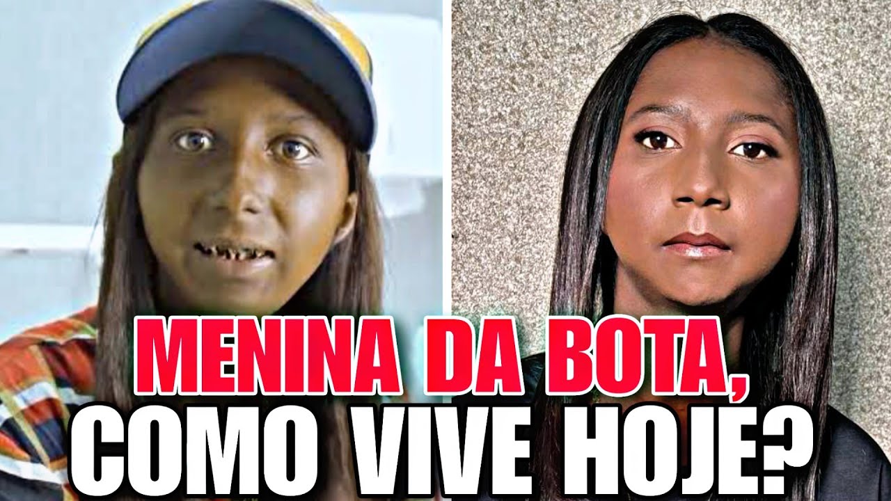 Ela Venceu! A Incrível História de Sucesso da Menina da Bota. - YouTube