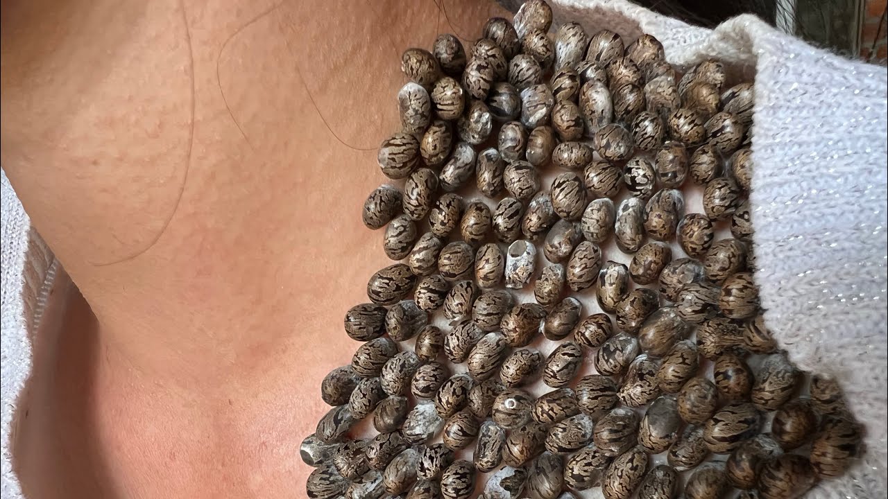 ticks plaque#033 - YouTube