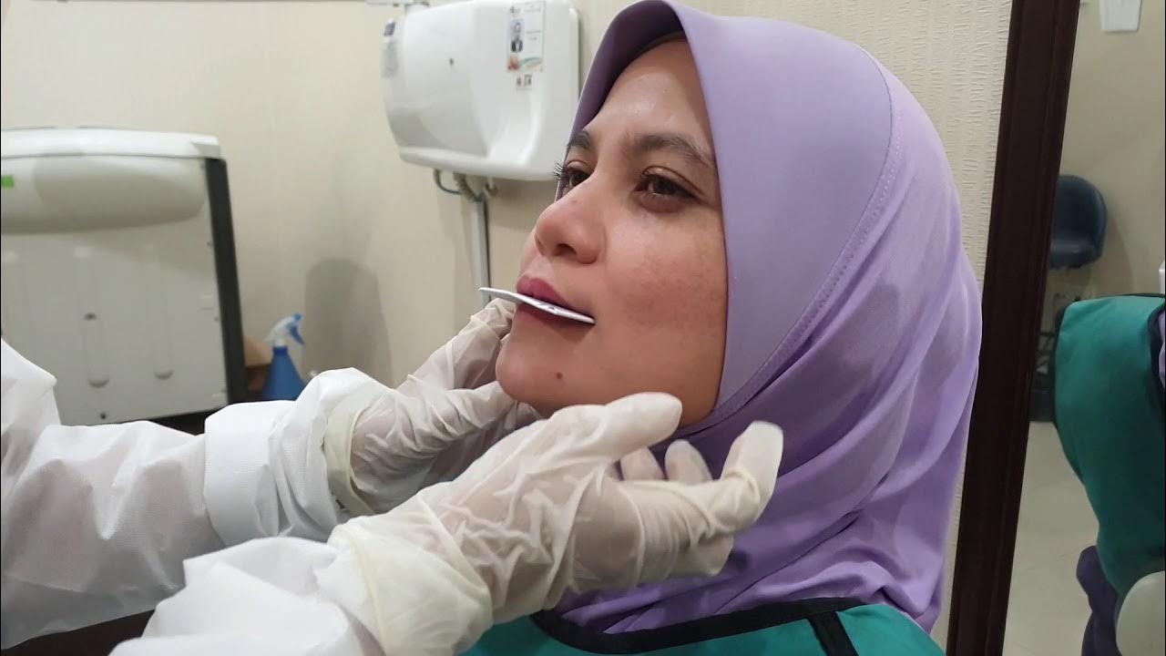 GNT208 - Taking lower occlusal view x-ray - YouTube GNT208 - Taking lower occlusal view x-ray - YouTube