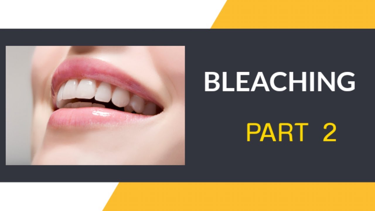 BLEACHING (PART 2) [ CLASSIFICATION, DIAGNOSIS & TREATMENT PLANNING ...