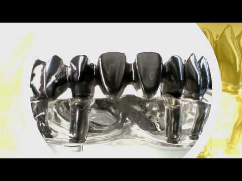 BEGO Implant Systems – Dental implants, made in Germany
