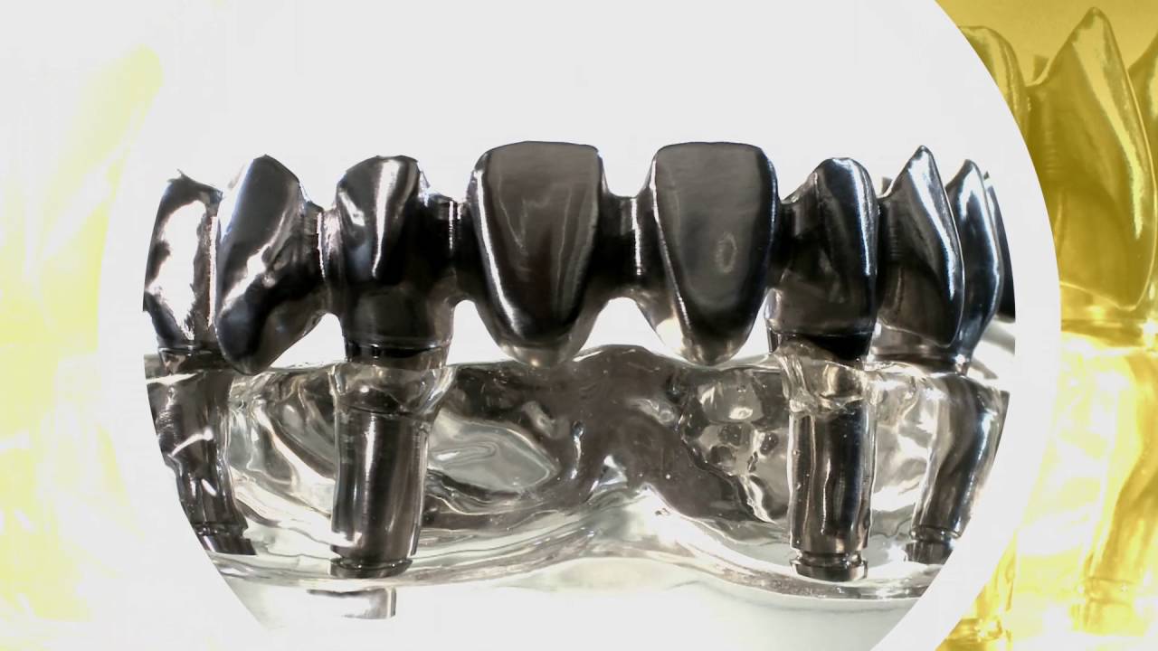 BEGO Implant Systems – Dental implants, made in Germany - YouTube