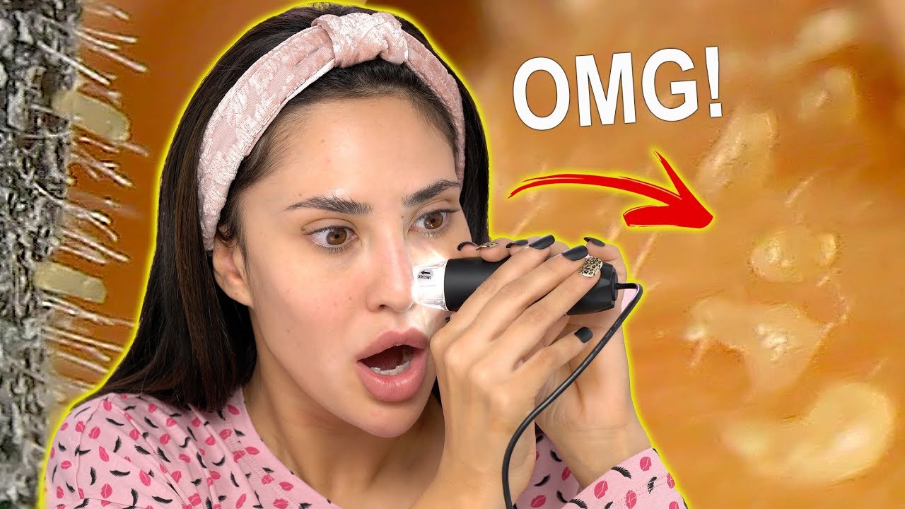 BLACKHEAD PEEL-OFF NOSE STRIP UNDER A MICROSCOPE ... Oddly Satisfying ...