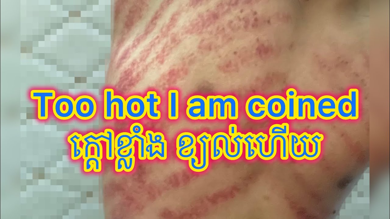 Too hot the weather I am getting coined - YouTube