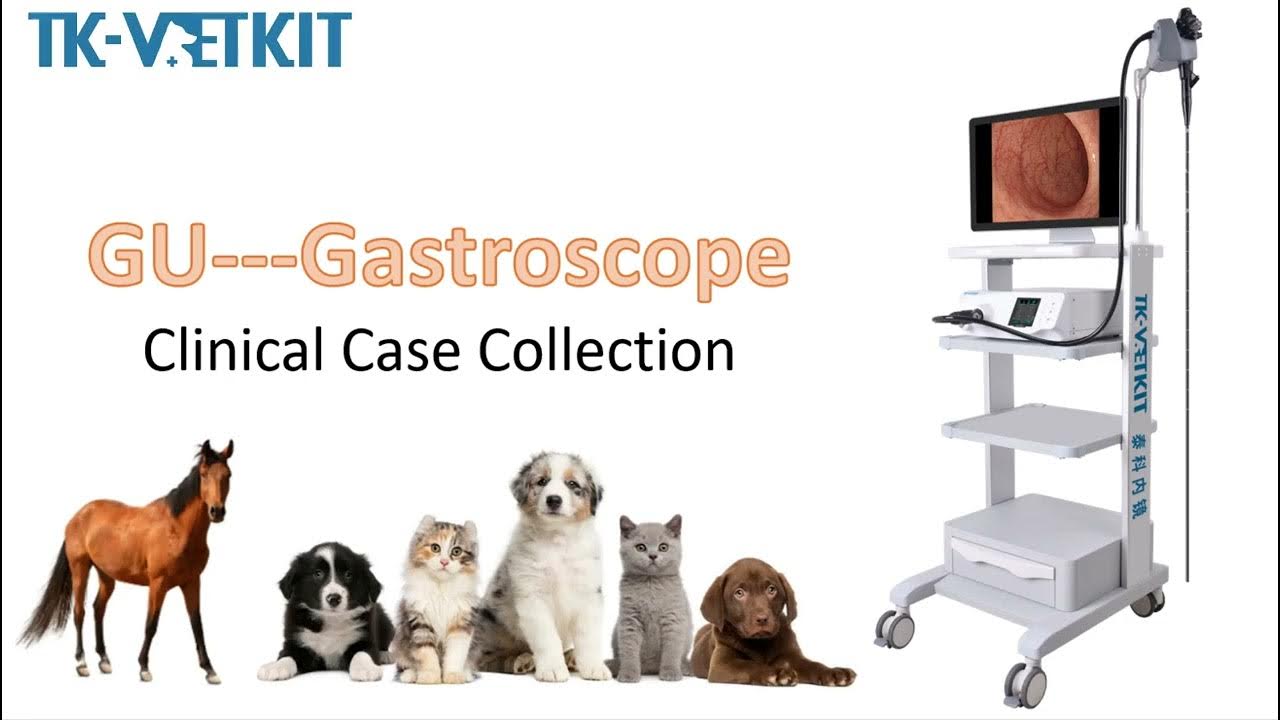 GU clinic case collection - YouTube