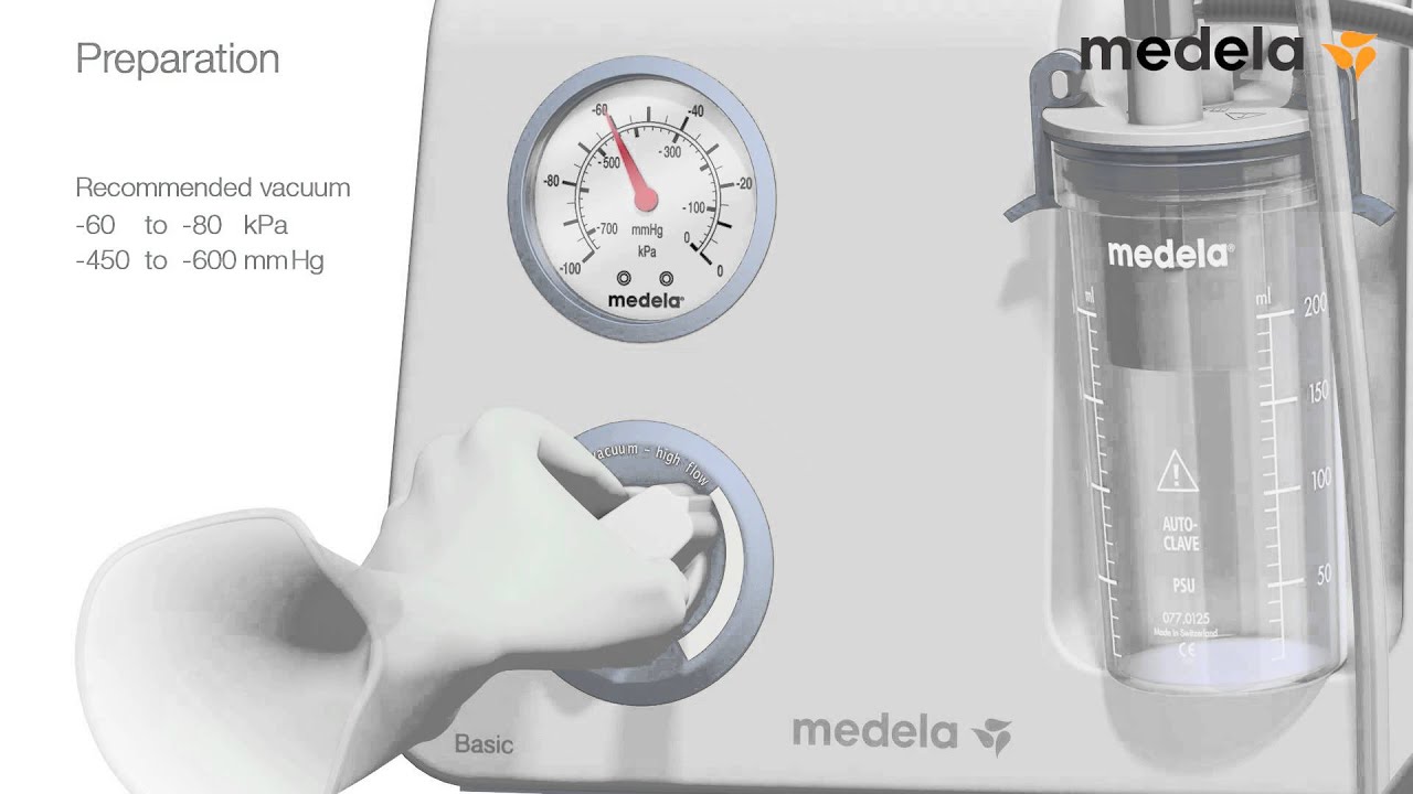 Basic Suction Pump Vacuum Assisted Delivery System Medela Brochure
