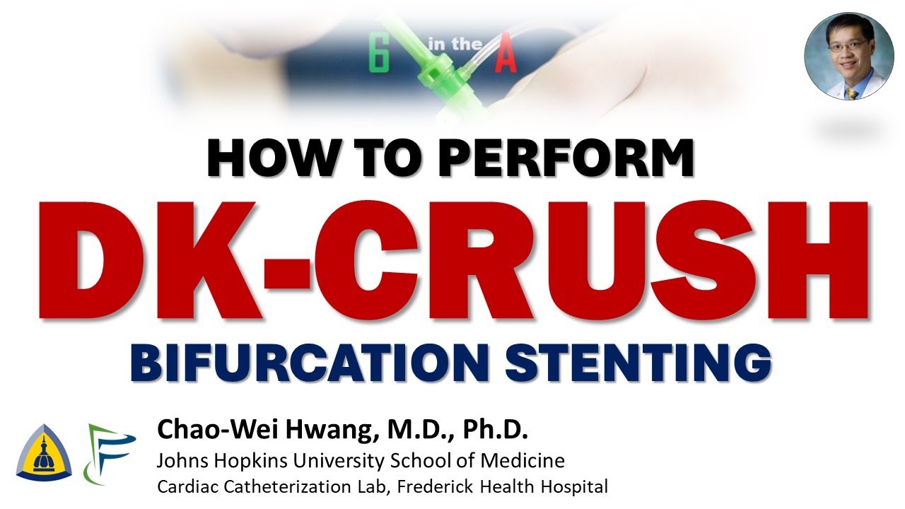 DK Crush: Step by step - YouTube