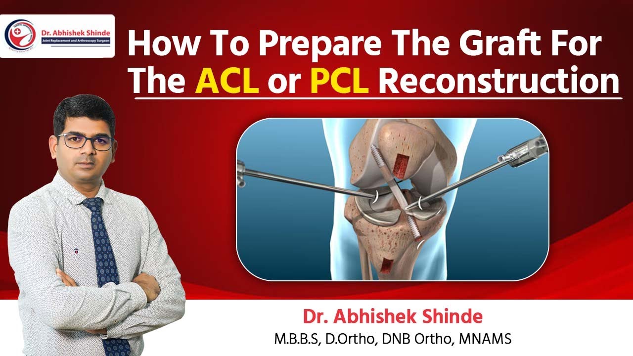 The Science Behind Preparing a Graft for ACL and PCL Reconstruction ...