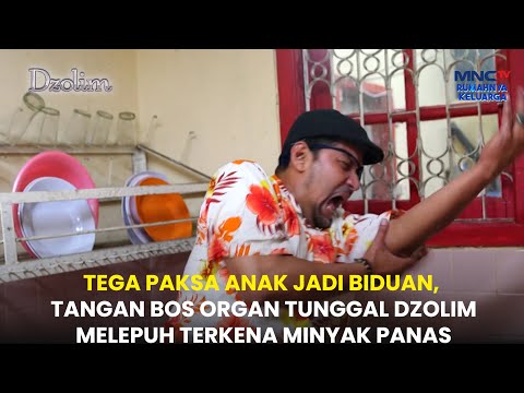 Tega Paksa Anak Jadi Biduan, Tangan Bos Organ Tunggal Dzolim Melepuh Terkena Minyak Panas | DZOLIM