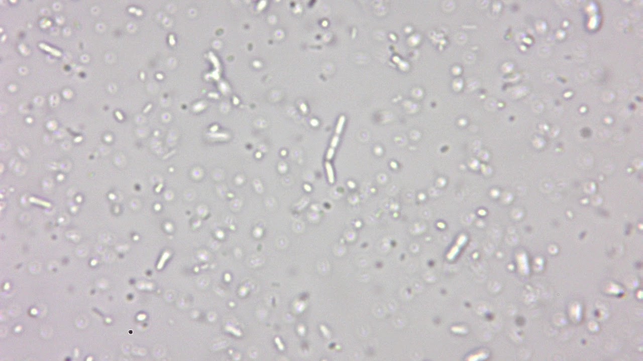 Microbial Activity in Compost Tea - 24 Hour - YouTube