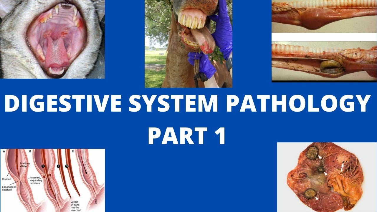 digestive system pathology 1|pathology of digestive system|digestive ...