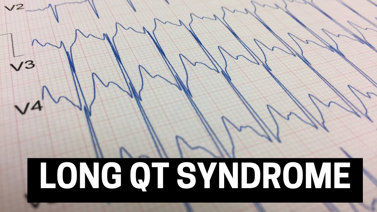 Understanding Long QT Syndrome (LQTS): Symptoms, Diagnosis, & Treatment ...