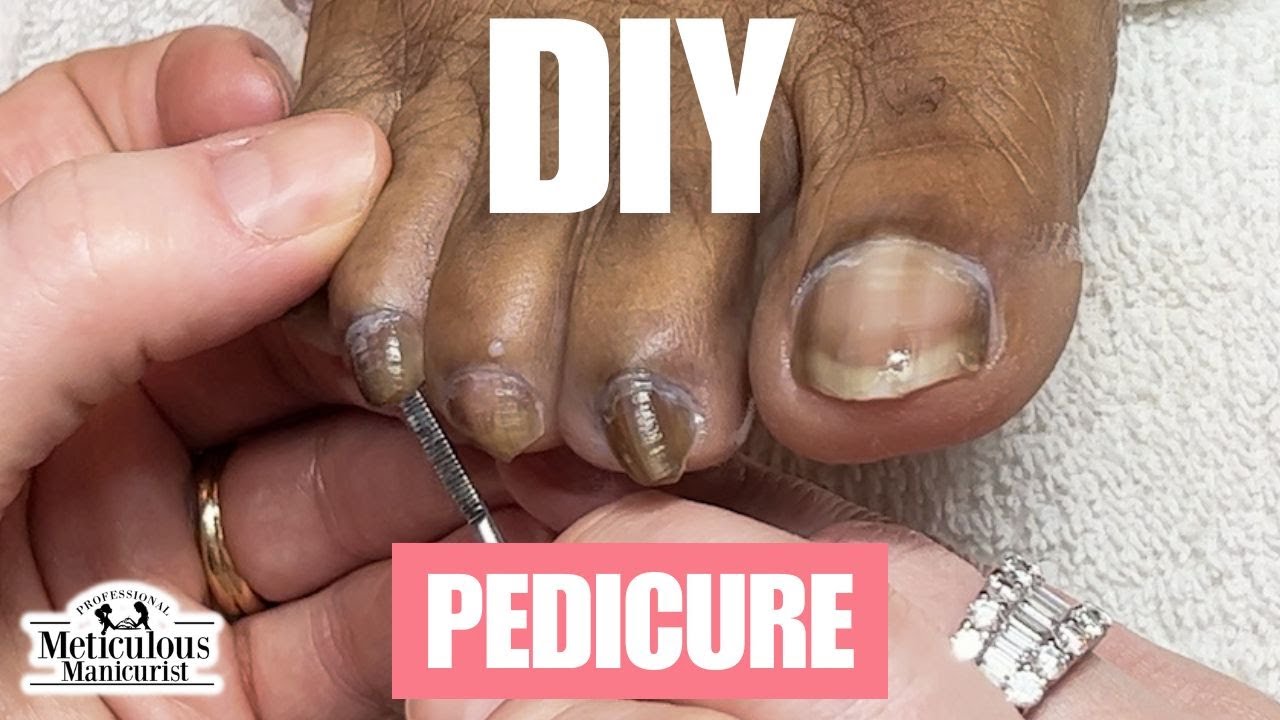 Pedicure at Home Amazing Toenail Cleaning - YouTube